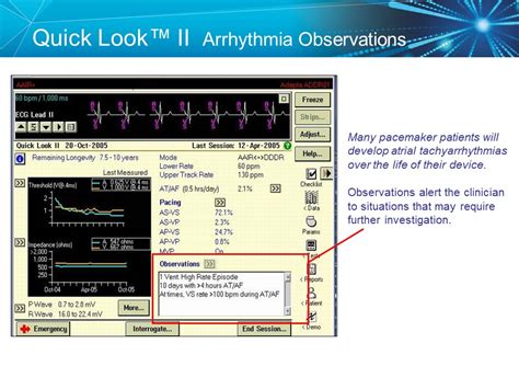 Cvt Mohd Farid Pacemaker Follow Up Part Ii Medtronic Academy