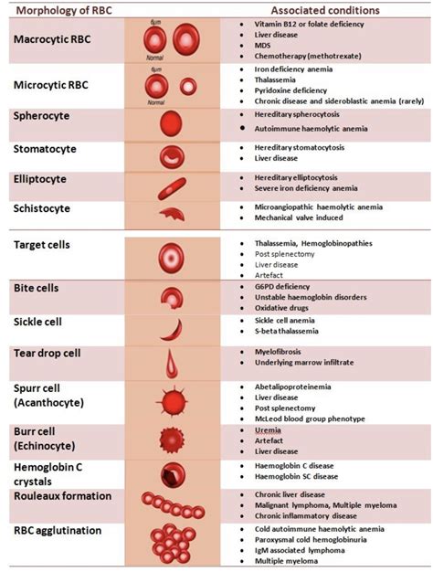 Morfología De Eritrocitos Hematología Ciencia Del Laboratorio Clínico Eritrocitos