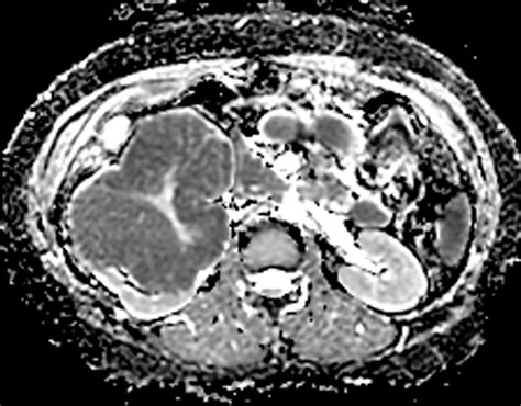 Images And Quiz British Columbia Radiological Society