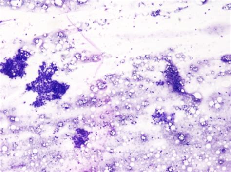 March The International Academy Of Cytology