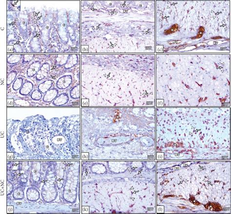 Photomicrographs Of Cd34 Immunohistochemical Stained Sections In The Download Scientific