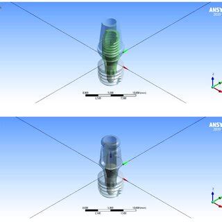 Different Abutment Designs According To The Prosthetic Material A Download Scientific