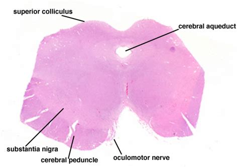Chapter 1 Normal Gross Brain And Microscopy Renaissance School Of