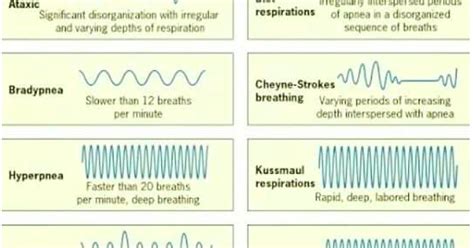 Semiologia Tipos De Respiración Kussmaul Cheyne Stokes Biot Video