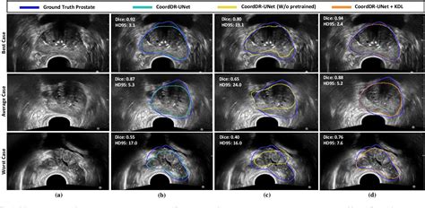 Figure 1 From Domain Generalization For Prostate Segmentation In