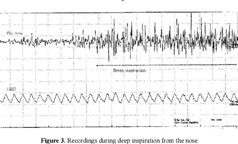 Structure Of Thyrohyoid Ligament Semantic Scholar