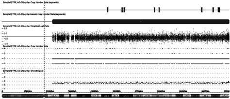 An Example Of Microarray Analysis Of Chromosome Log Ratio And Download Scientific Diagram