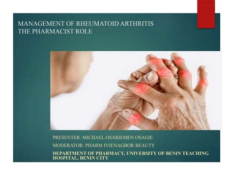 Managementofrheumatoidarthritis 1 1 1pptx