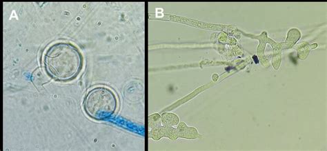 Características Morfológicas De Pythium Sp A Oogonios Con Oóspora Y