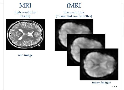 Figure 6 From A Practical Guide To An Fmri Experiment Semantic Scholar