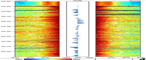 bilateral bispectral index monitoring performance in the det
