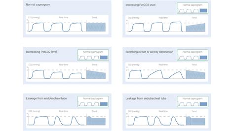 Types Of Capnography Capnography And Pulse Oximetry Twfn