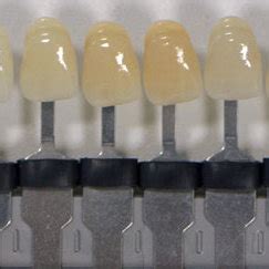 PDF Comparison Of Visual Shade Matching And Electronic Color Measurement Device