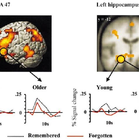 Main Effect Of Subsequent Memory Common To Both Age Groups Exclusively