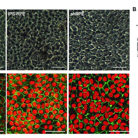 Phenotypic Comparison Between Different Sources Of Rpe A Phase Download Scientific Diagram