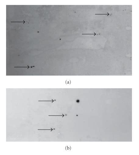 A 32p Labeled Probes Hybridized To Sex Differentiating Genes On