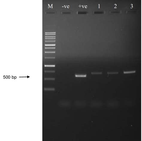 Scanning Electron Microscopy Sem Analysis Of Panus Lecomtei At Seven