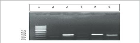 Nested Rt Pcr For Hcv Well 1 100 Bp Marker Fermentas Usa Well 2