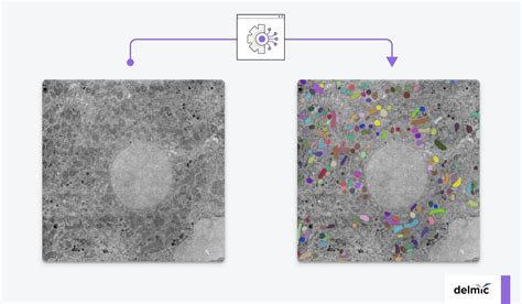 volume electron microscopy towards automatic organelle segmentation