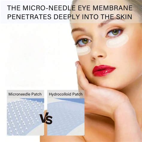 Eye Patch Micro Needle Hyaluronic Acid Soluble Dissolving Microneedle Under Eye Patch For Sale