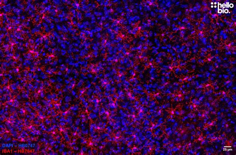 Anti Iba1 Antibody Validab™ Rabbit Polyclonal Iba1 Microglial