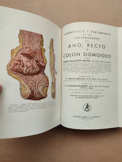 Diagnóstico y Tratamiento De Las Enfermedades Del Ano, Recto y Colon Sigmoideo. by BACON, H.E ...