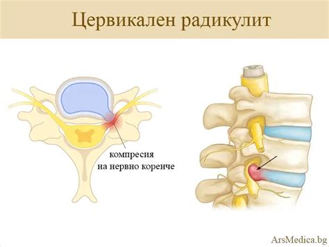Ердомед капсули 300 мг при хроничен бронхит ХОББ Arsmedica Bg