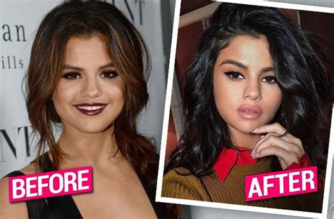 Selena Gomez Plastic Surgery Rumors Before Qrjmn