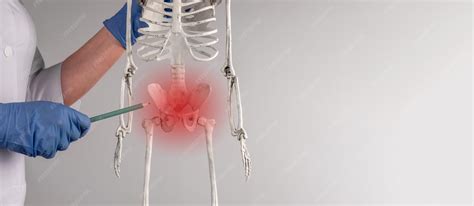 Lesión Por Traumatismo óseo Pélvico En La Pelvis Y Concepto De Dolor En