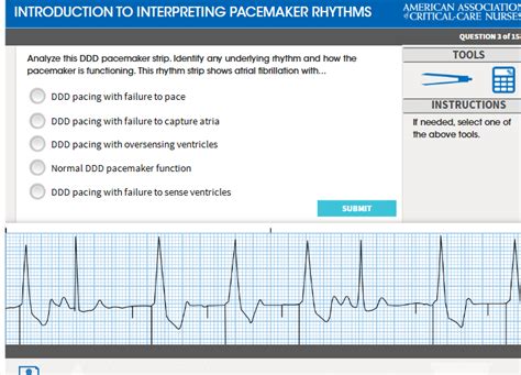 Solved Analyze This Ddd Pacemaker Strip Identify Any