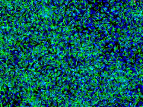 HiPSC Derived Neural Stem Cells