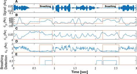 Figure 1 From Diagnosis Of Obstructive Sleep Apnea Using Speech Signals From Awake Subjects