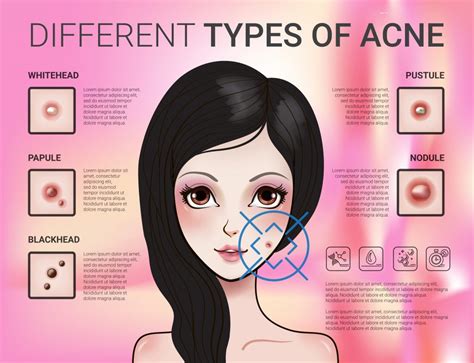 Understanding And Treating Different Types Of Acne The Naked Chemist