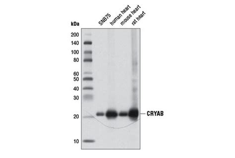 Cryab Antibody Cell Signaling Technology