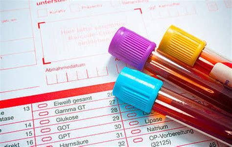 New Model For Predicting Deep Vein Thrombosis And Pulmonary Embolism In