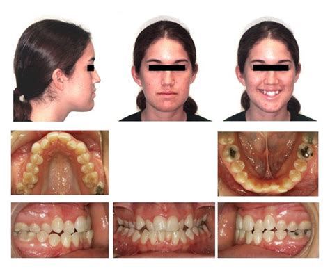 Jaw Mens Self Improvement And Aesthetics