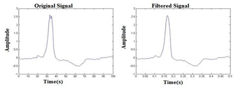 A Original Ecg Signal B Filtered Ecg Signal Using Savitzky Golay