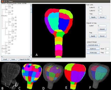 Treej Un Plugin Interactif Dimagej Pour Reco