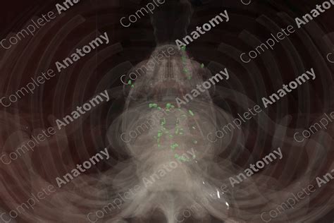 Mediastinal Lymph Nodes Complete Anatomy