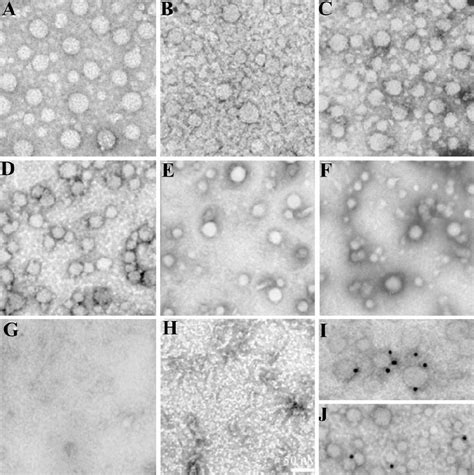 Electron Micrographs Of Hcv Nlps Generated From Recombinant Proteins Download Scientific