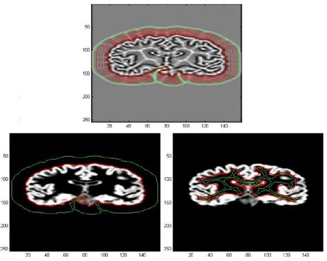 Edge Extraction With Avf Force Field After 8 Iterations Download
