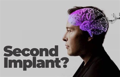 raniya kelifa on linkedin neuralink elonmusk bci