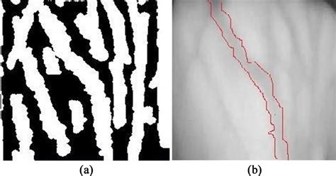 Automatic Detection And Characterization Of Human Veins Using Infra Red Image Processing