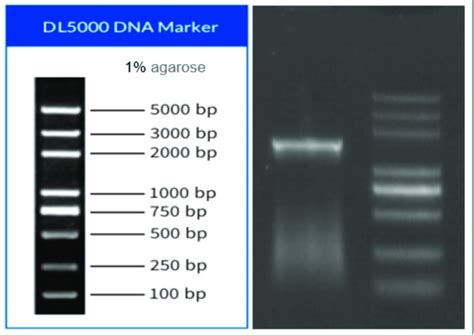 Dna Marker Bands Of Ochrobactrum Intermedium K1 Download Scientific