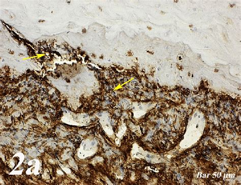 A Osteonectin Immunostaining Control Group Positive Expression Of Download Scientific