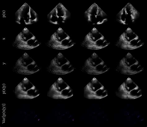 Diffusion Models For Ultrasound Image Generation Zea 004 Documentation