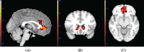 Significant Gender Modulation Of Nonlinear Responses To Variations In Download Scientific