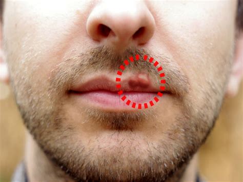 Unknown Facts About Love Bites