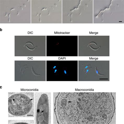 Microconidium Germination And Examination For Mitochondria A Download Scientific Diagram