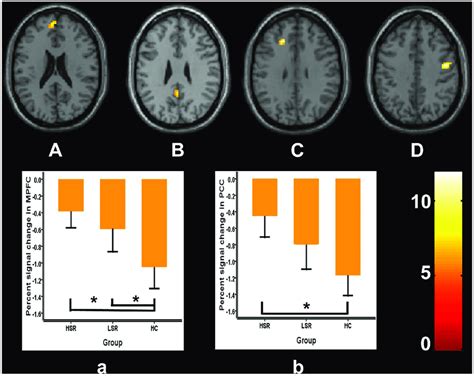 Regions With Significant Activations At Rest State Among Three Groups Download Scientific